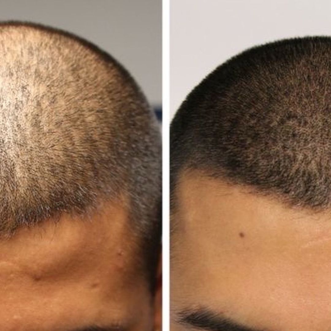 Plastic Surgery Photo Gallery